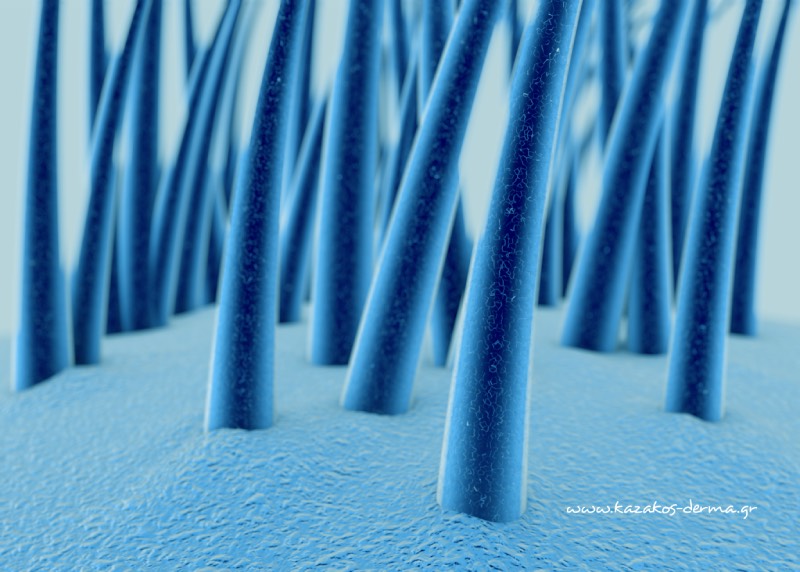 Παθήσεις-Τριχών Archives - Δερματολόγος - Αφροδισιολόγος Χαράλαμπος Καζάκος